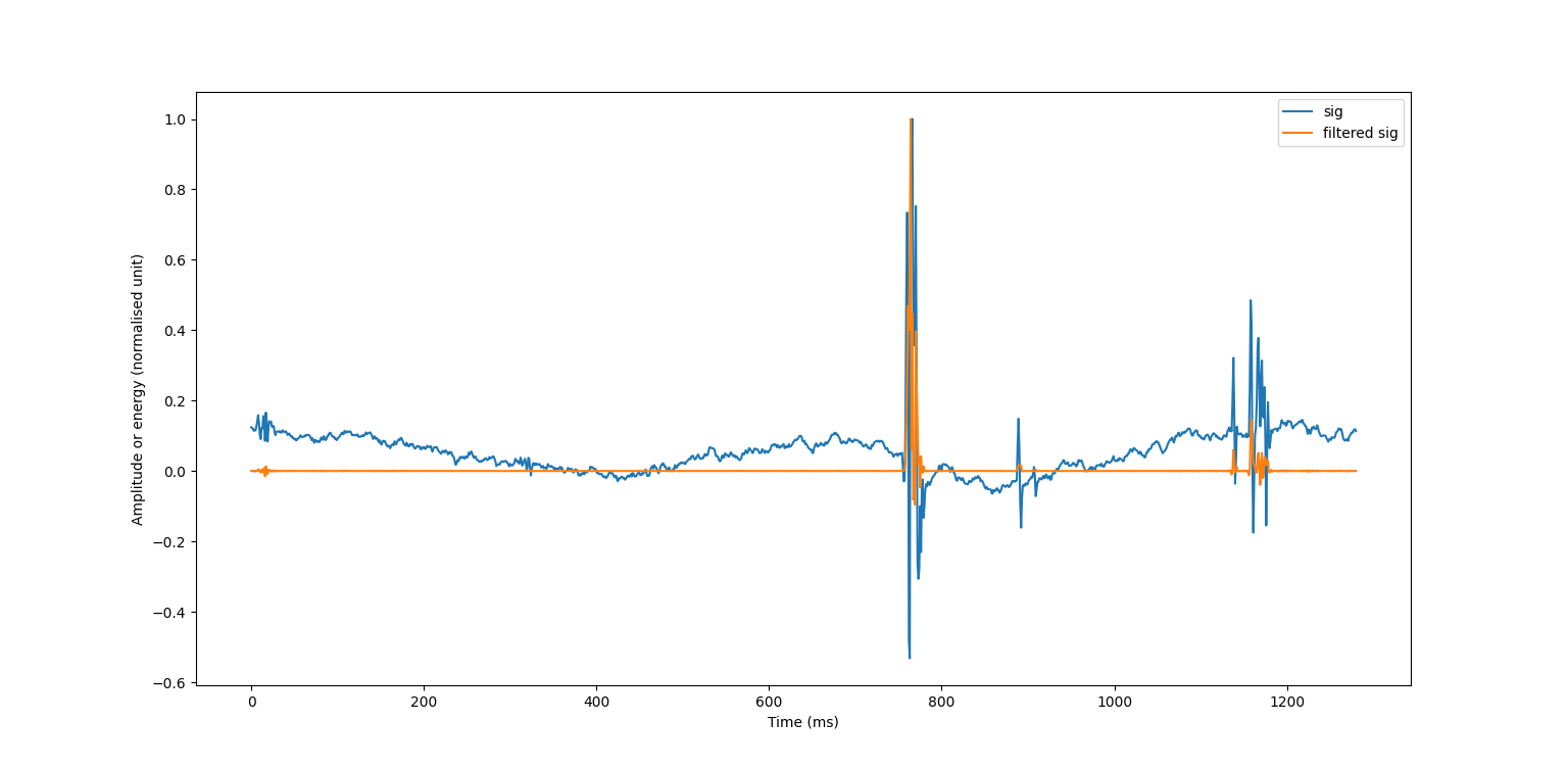 Filteringanddetectiononemgdata — Electrical And Neural Signal Processing Example 000